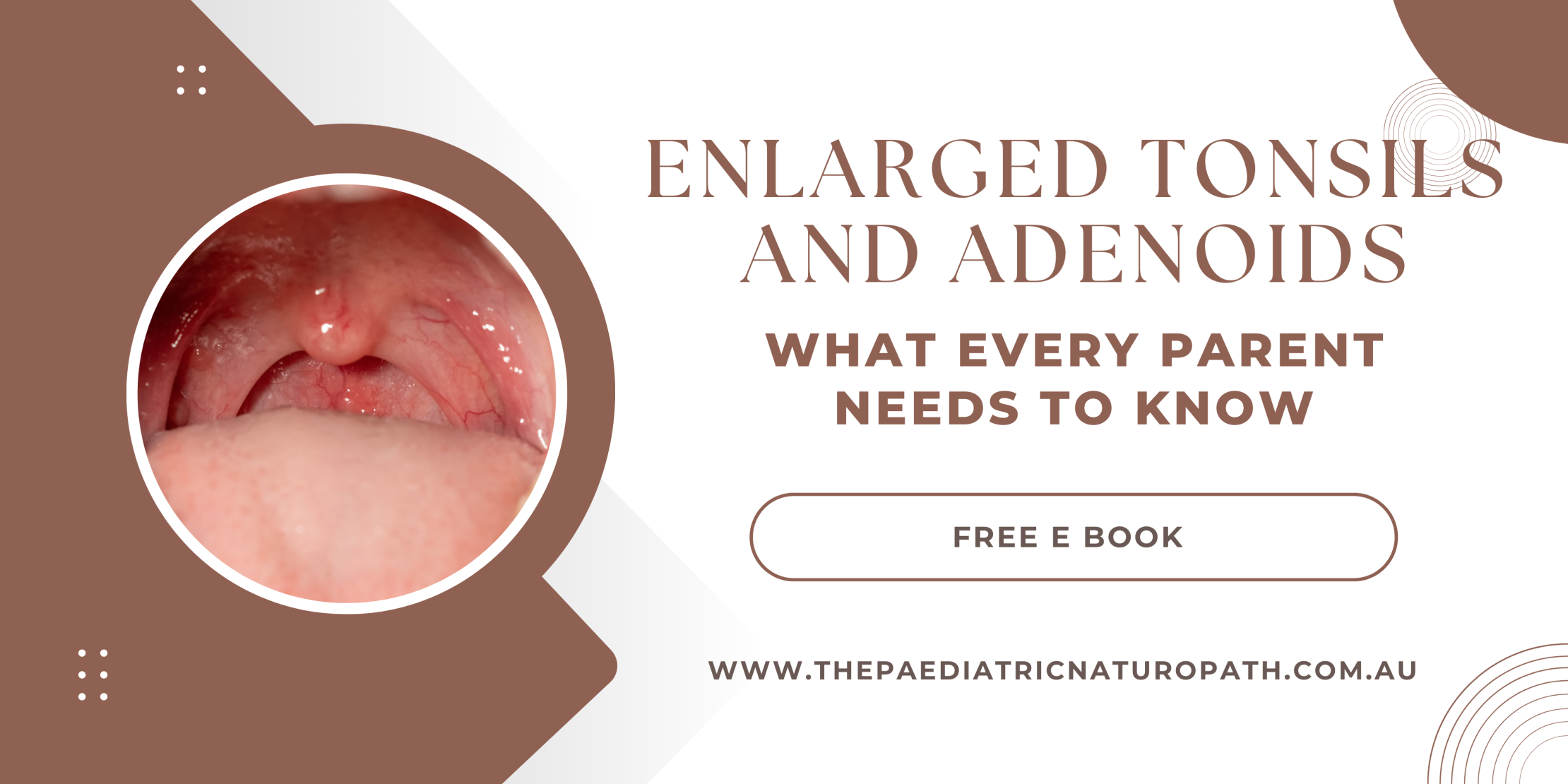 Tonsils & Adenoids Guide